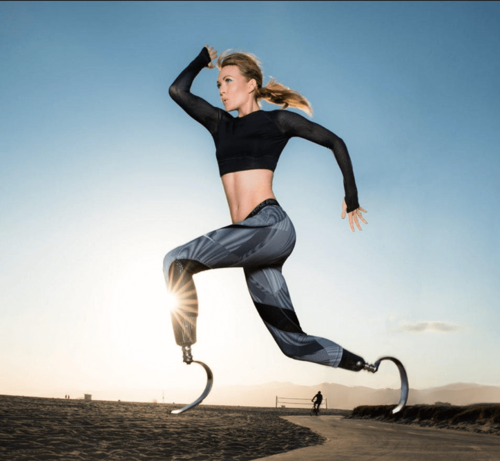 Amy Purdy On Overcoming Life-Altering Challenges, Winning Paralympic ...